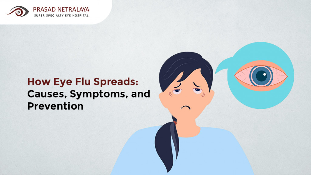 How Eye Flu Spreads: Causes, Prevention, and Expert Care